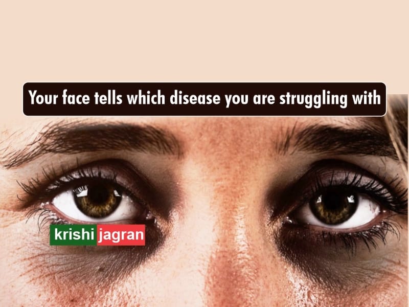 How Your Face Can Tell Which Disease You’re are Struggling With