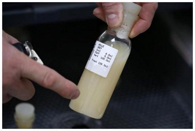 Examination & Properties of healthy Semen